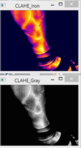 Blood Vessel Infrared Thermal Camera