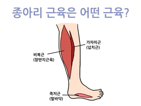 종아리 근육 통증 뭉침 원인과 풀기 네이버 블로그