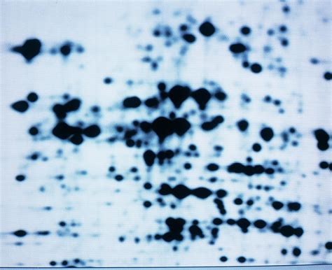 Proteomics Research Photograph By Medical School University Of