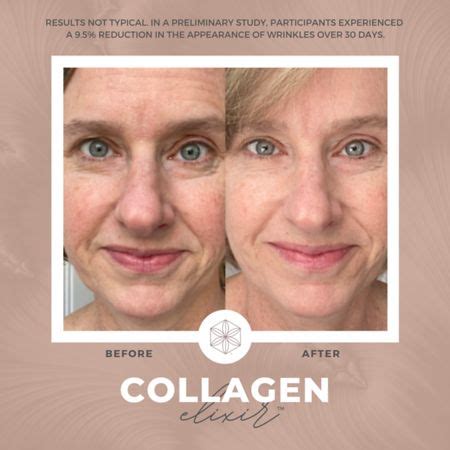 Collagen Elixir Before Afters Isagenix Collagen Collagen