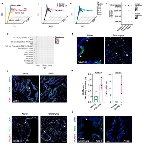 A Molecular Single Cell Lung Atlas Of Lethal COVID Abstract Europe PMC