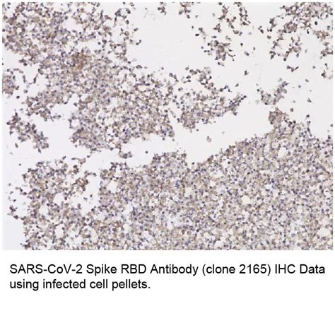 Anti Sars Cov 2 Spike Rbd Clone 2165 Hrp