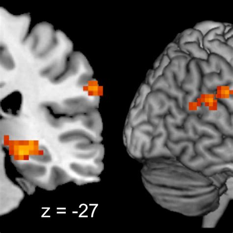 Schematic Diagram Of Brain Areas Recruited By Synchronized Speaking Download Scientific