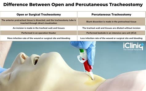 Percutaneous Tracheostomy Vrogue Co