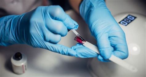 Understanding Platelet Count In Dengue Fever What You Need To Know