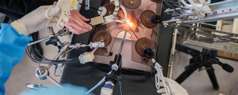 Robotic Assisted Hernia Treatment