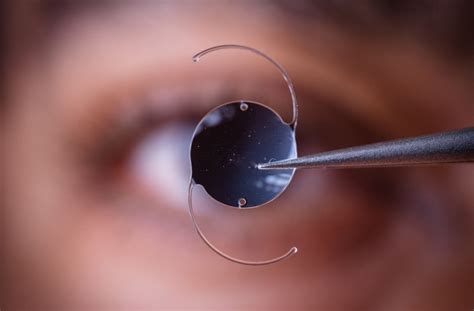 What Types Of Lens Implants Are Used In Cataract Surgery