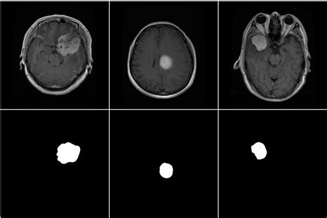 论文审查 Improved Unet Brain Tumor Image Segmentation Based On Gsconv Module And Eca Attention