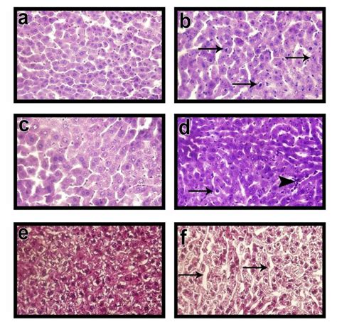 Photomicrograph Of Hande Stained Liver Sections A Control Group Liver
