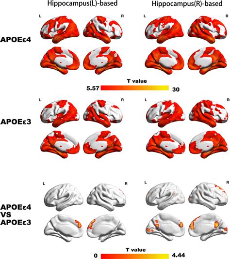 Functional Connectivity Influenced The Effect Of Apoe ε4 The Commonly
