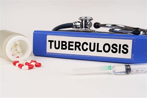 Sciencedirect Tuberculosis At Amy Macartney Blog