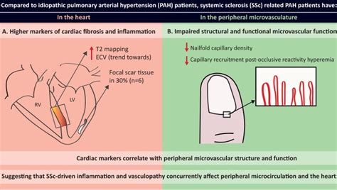 Peripheral Microvascular Function Is Linked To Cardiac Involvement On Cardiovascular Magnetic