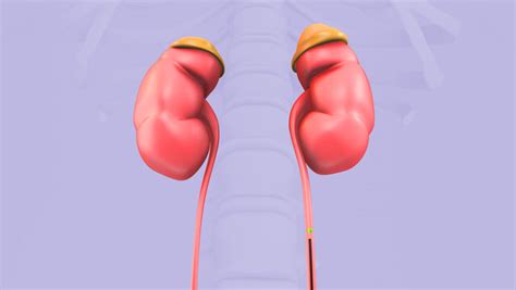 รูปภาพnephrolith เลือกดูภาพถ่ายสต็อก เวกเตอร์ และวิดีโอ5317 Adobe