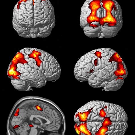 9 Best Functional Mri Images On Pinterest The Brain Brain And Brain Art