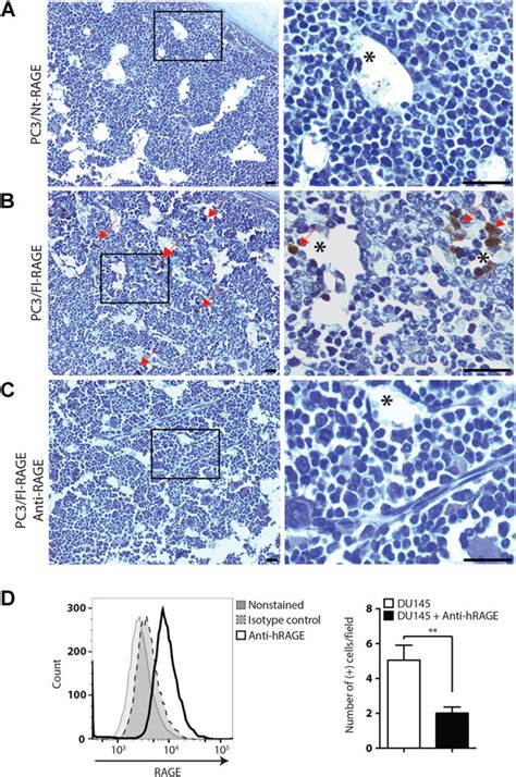 Rage Mediates Bone Marrow Homing Of Prostate Cancer Cells A D