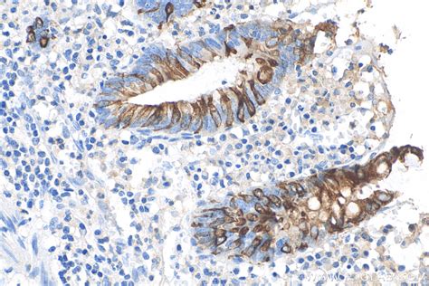 Cytokeratin 20 Antibody 82428 1 Rr Proteintech