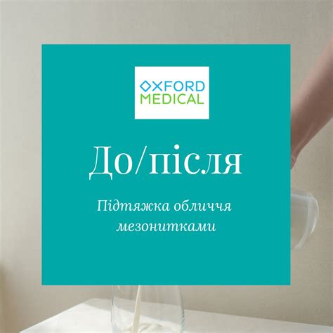 Oxford Aesthetics Процедура червоної килимової доріжки Вогонь та лід в МЦ Оксфорд Медікал