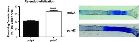 Intracellular Delivery Of Poly Ic In Vivo Reduces Reendothelialization