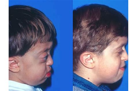 About Dr Sargent Sargent Plastic Surgery Of Utah