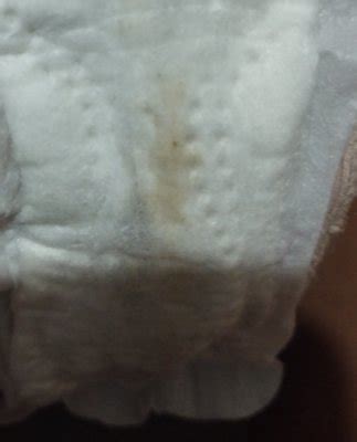 Flujo Vaginal Babycenter