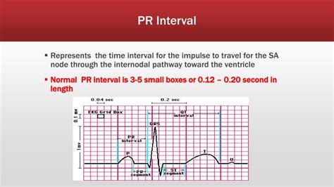 Ppt Ekg Powerpoint Presentation Id3835591