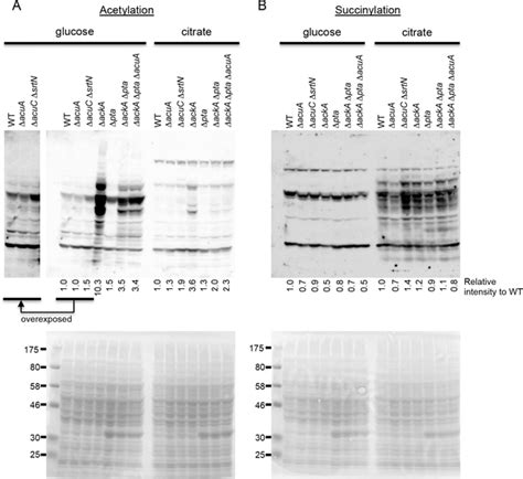 Succinylation Plos One