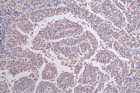 Ddb2 Recombinant Monoclonal Antibody Cusabio
