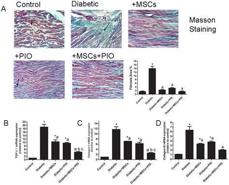 A Representative Masson Trichrome Staining Of Cardiac Sections Of The