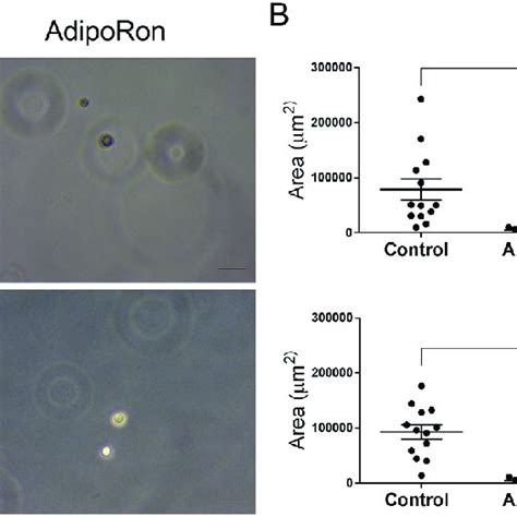 Adiponectin Receptor Agonist Adiporon Promotes Pancreatic Cancer Cell