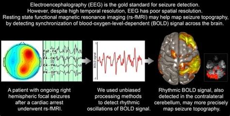 eeg brain language
