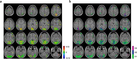 Optimized Latency In A Native Brain A Latency Map For Voxels From