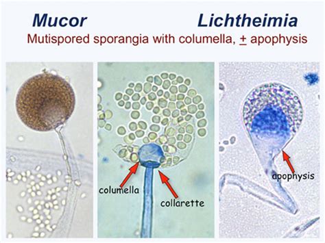 Zygomycota Rhizopus Asexual