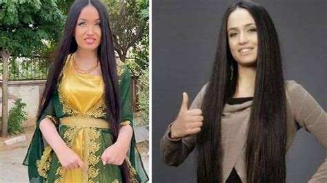 Ses Yarışmasında Tanınmıştı Sevgilisi Tarafından Başından Vurulan