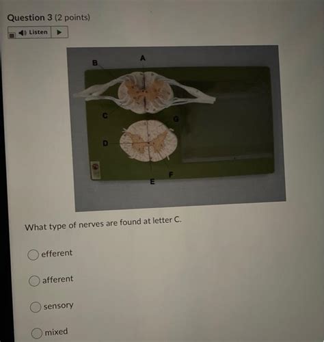 Solved Which Structure Is Highlighted Ventral Rootlets Dorsal Root
