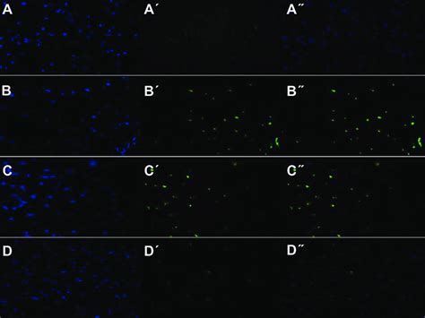 Sections Containing The Cerebral Cortex Were Double Labeled With A