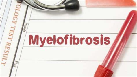 Fda To Review Nda For Momelotinib To Treat Myelofibrosis Mpr