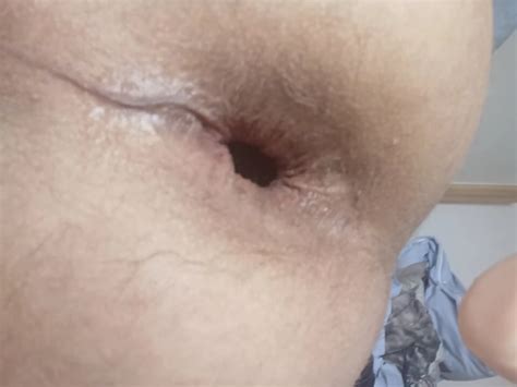 Pose Free Gay Amateur Hd Videos Porn Video Da Xhamster