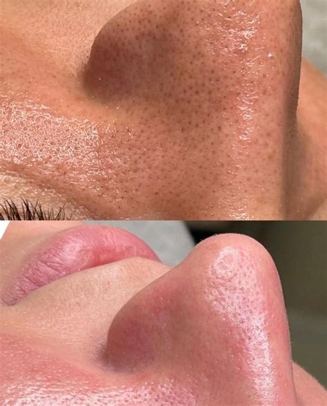 Ochic Ochic Ochicbeautycenter • Instagram Photos And Videos