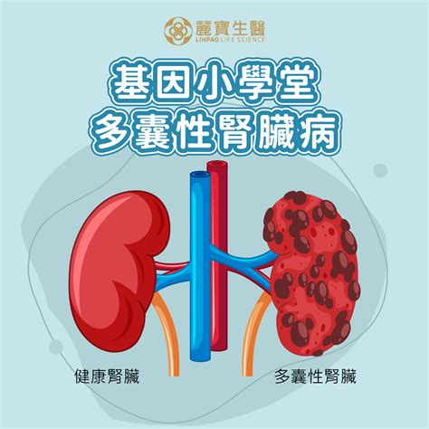 洗腎王國的熱點腎病 多囊性腎臟病 麗寶基因