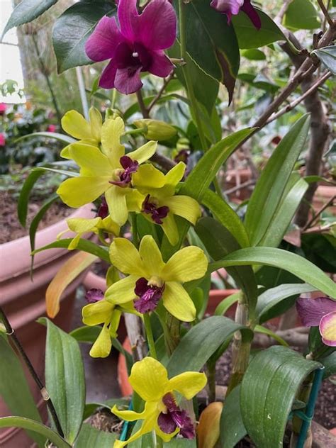 Living With Scleroderma Reflections On The Messy Complexity Of Chronicity