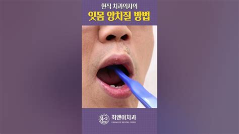 치과의사가 직접 보여주는 올바른 잇몸 양치질 Shorts Youtube