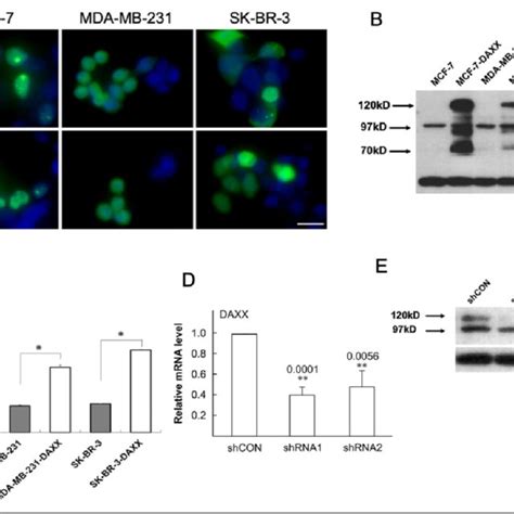 Daxx Expression In Human Breast Cancer Cell Lines A Download