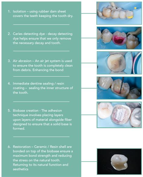 Biomimetic Restorative Dentistry Kush Dental