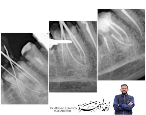 Ahmed Elsamra On Linkedin Radix ️ ️