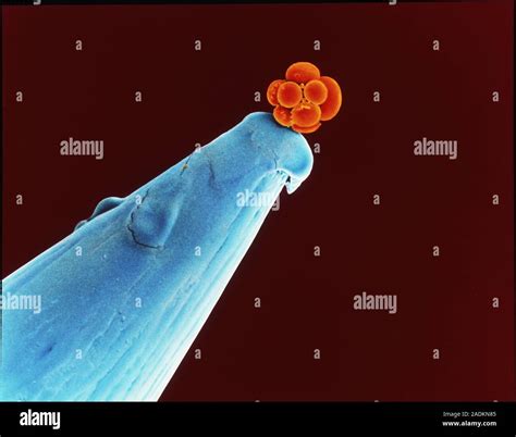 Human Embryo Coloured Scanning Electron Micrograph Sem Of A Human