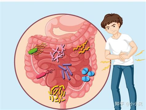 Ii型糖尿病和胰岛 β 细胞损伤机制 知乎