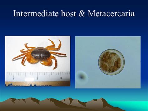 Intestinal Flukes Causal Agent The Trematode Heterophyes