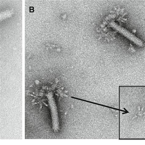 Electron Micrographs Of Salmonella Phage Vii A Complete Phage Vii