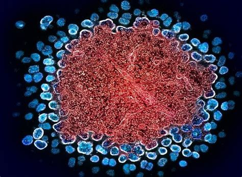 A New Frontier Crisprs Role In Excising Hiv From Infected Cells