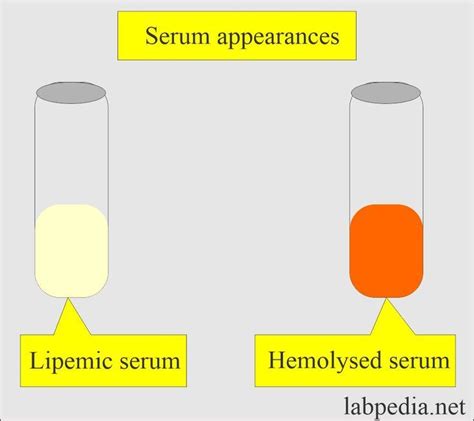 Common Lab Errors And Effect Of Various Anticoagulants On Tests Anticoagulant Lab Pathology Lab